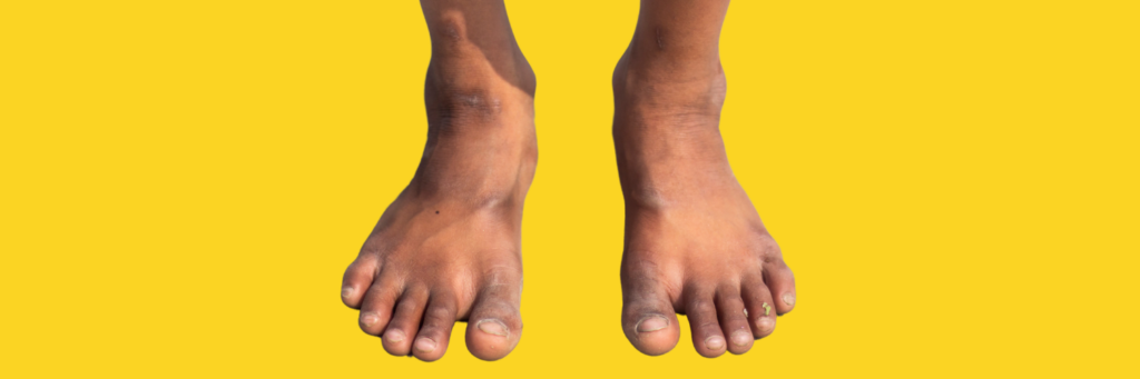 What’s the Big Deal About The Big Toe? - Brad Kearns